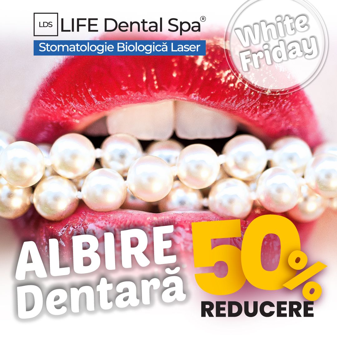 Albire Dentara Laser | Lifedentalspa.ro