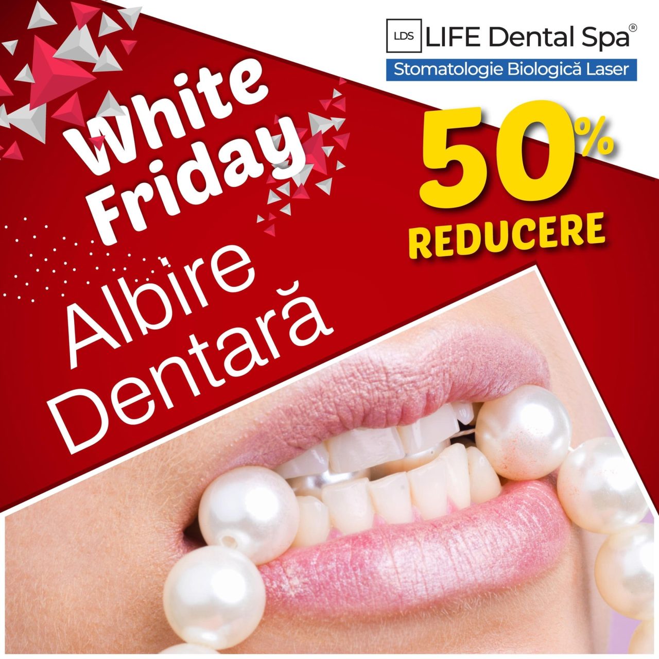 Albire Dentara Laser | Lifedentalspa.ro